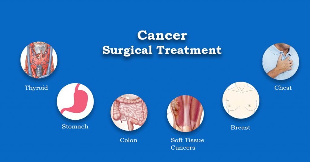 Cancer Surgery In Kochi Dr R Padmakumar